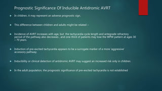 Avrt vz vt | PPTX