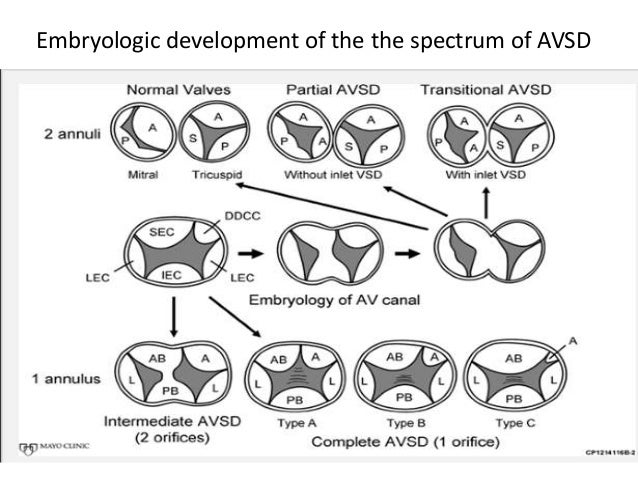 atio ventricular septal defects