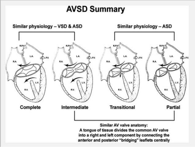 atio ventricular septal defects