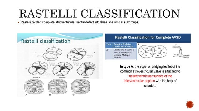 AVSD.pptx | Pregnancy | Reproductive Health