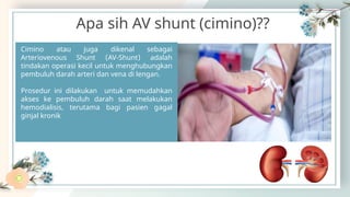 ppt................................... AV Shunt kel 2.pptx