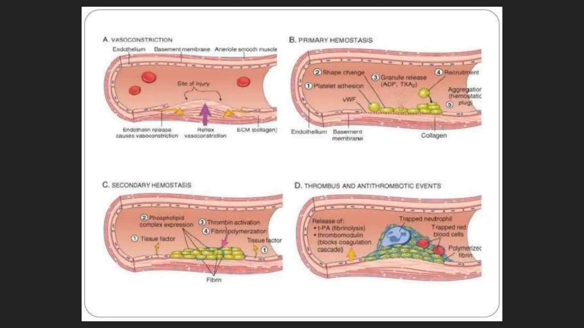 Post-operative thrombosis and embolism.pptx