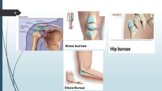 Topic- Bursitis .pptx
