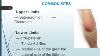 Topic- Bursitis .pptx