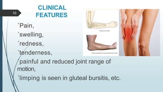 Topic- Bursitis .pptx