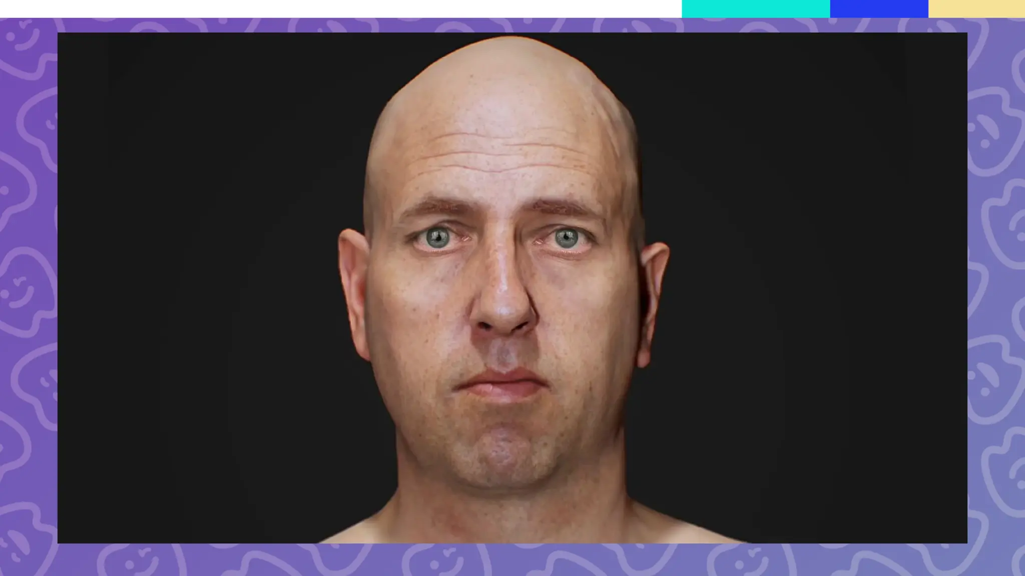 Avulsi dan Dislokasi pada Rongga Mulut dan gigi | PPTX