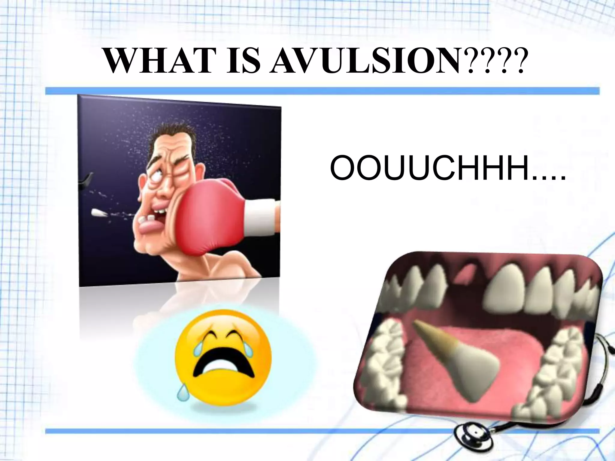 Avulsion | PPTX