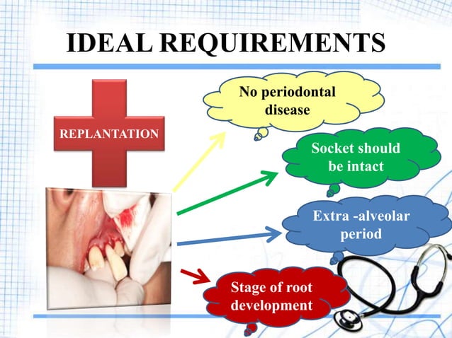 Avulsion | PPTX | Dental Health | Diseases and Conditions