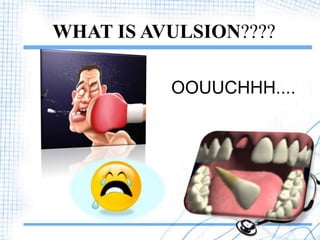 Avulsion | PPTX