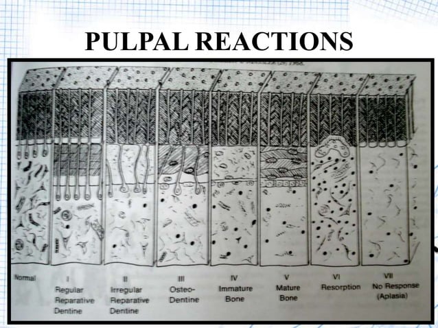 Avulsion | PPTX | Dental Health | Diseases and Conditions