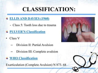 Avulsion | PPTX