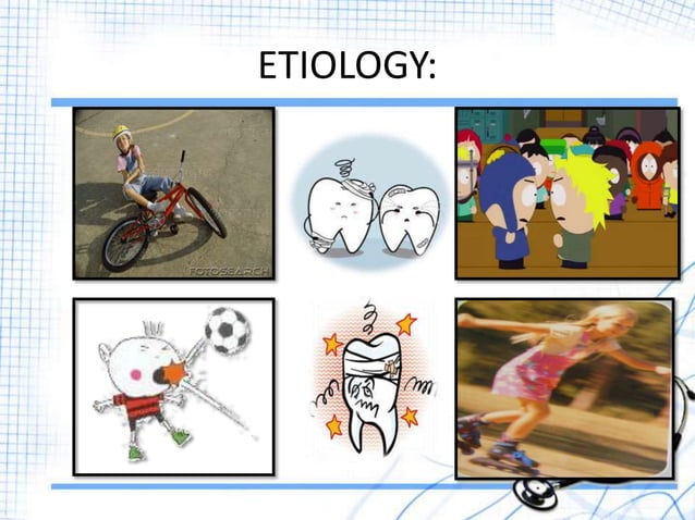 Avulsion | PPTX | Dental Health | Diseases and Conditions