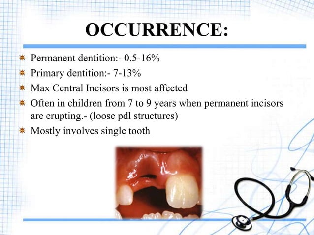 Avulsion | PPTX | Dental Health | Diseases and Conditions
