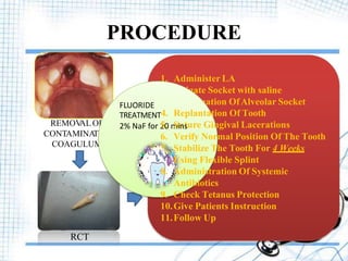 Avulsion.pptx