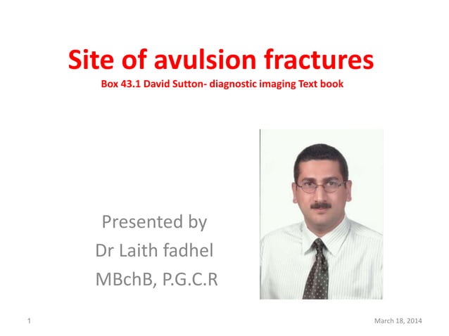 Avulsion fractures | PPT