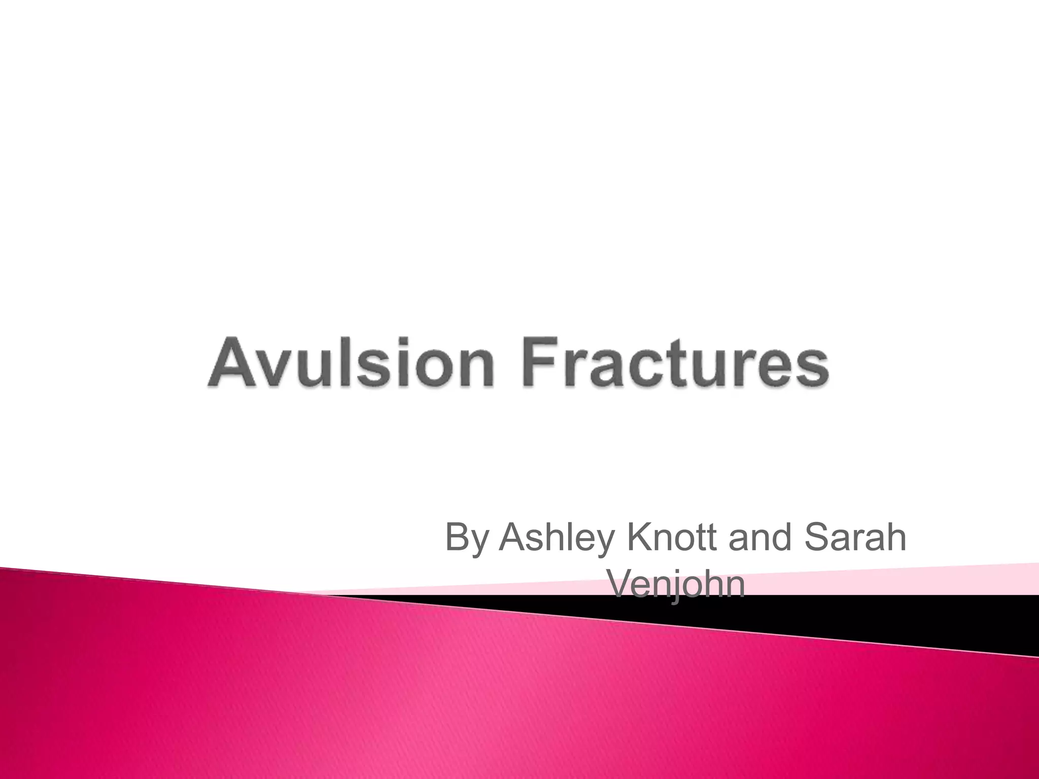 Avulsion fractures ppt ashley and sarah musculo[1] | PPT