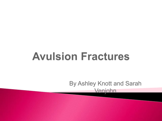 Avulsion fractures ppt [1] | PPTX