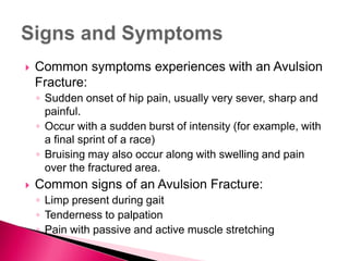 Avulsion fractures ppt [1] | PPTX