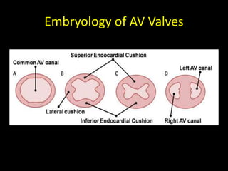 Atrioventricular valves (Mitral and Tricuspid) - Surgical anatomy | PPTX