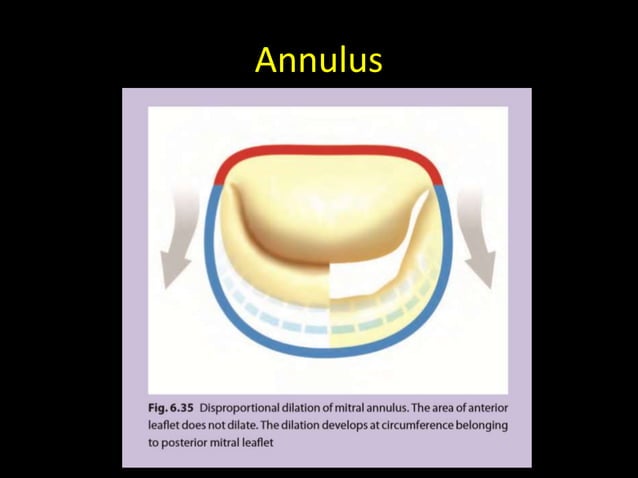 Atrioventricular valves (Mitral and Tricuspid) - Surgical anatomy | PPT