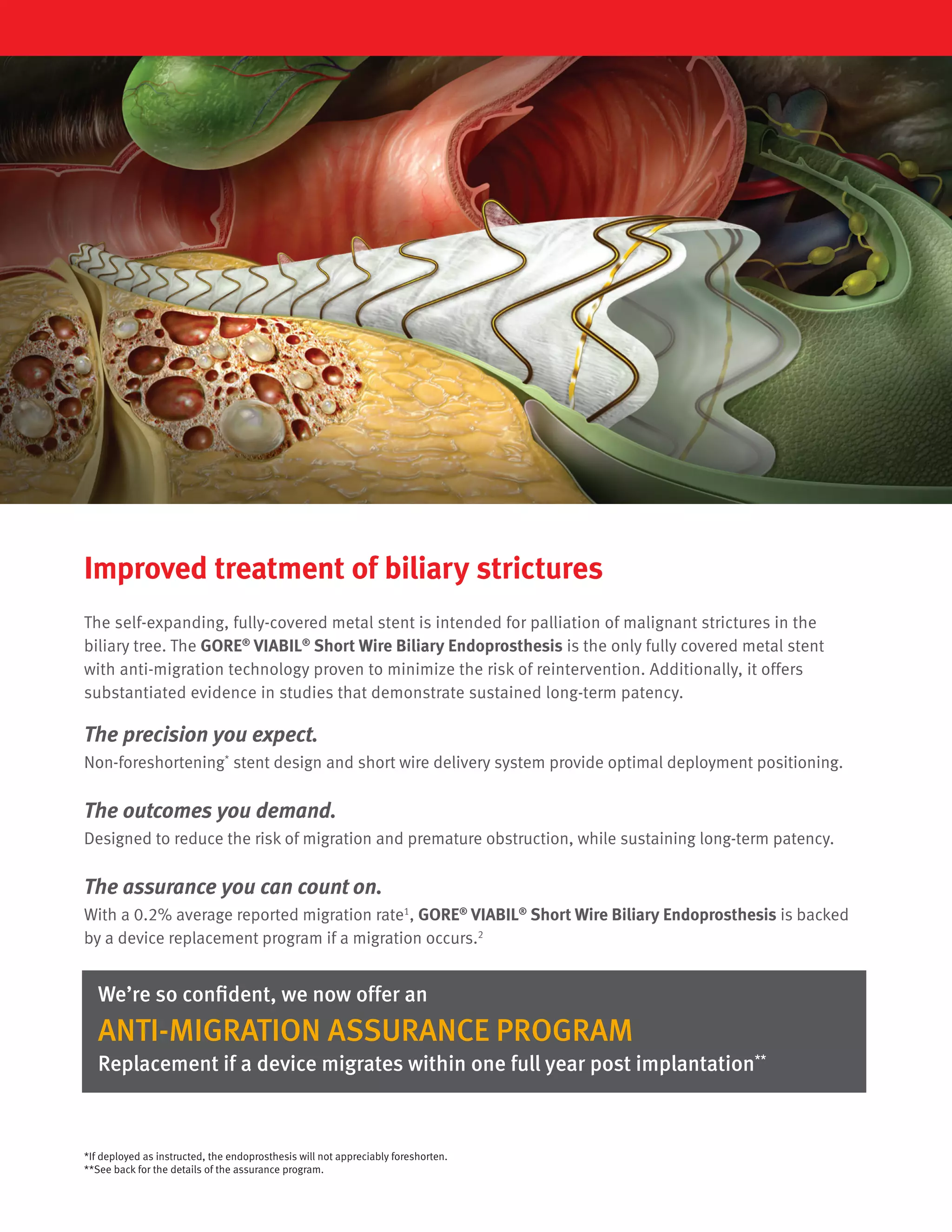 GORE® VIABIL® Short Wire Biliary Endoprosthesis - Product Brochure | PDF