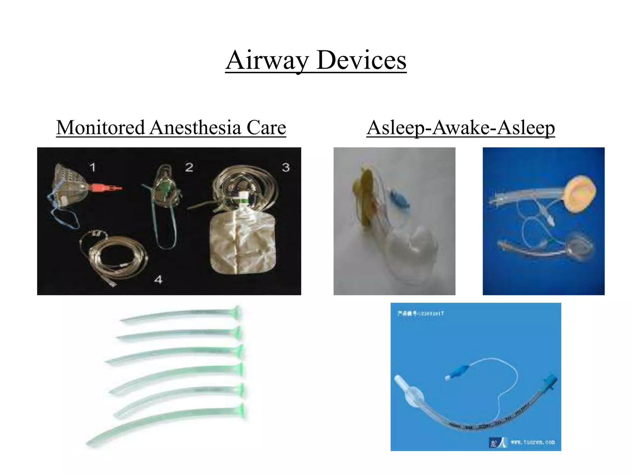 Awake craniotomy | PPTX