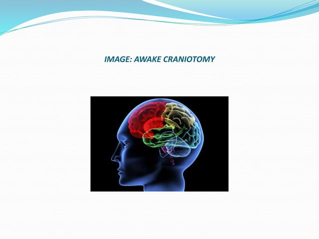 Awake Craniotomy | PPTX | Ear, Nose and Throat Conditions | Diseases ...