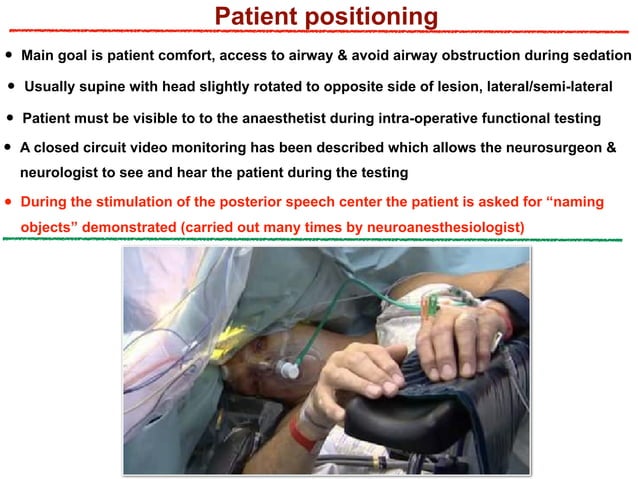 Awake craniotomy | PDF