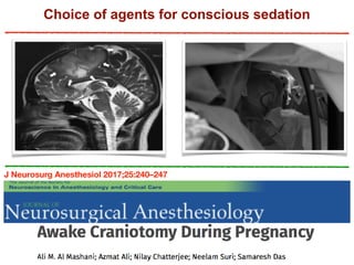 Awake craniotomy | PDF