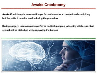 Awake craniotomy | PDF