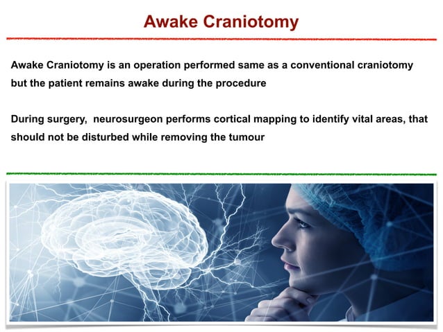Awake craniotomy | PDF