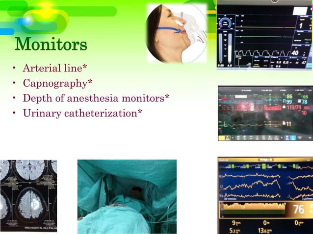 Awake Craniotomy Anaesthesia.pptx
