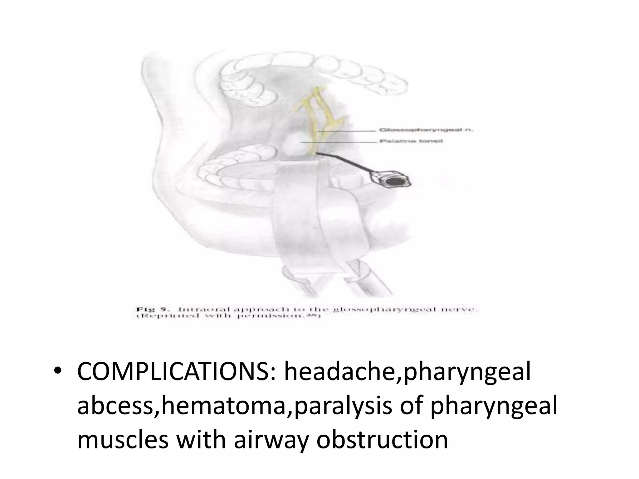 Awake intubation | PPTX