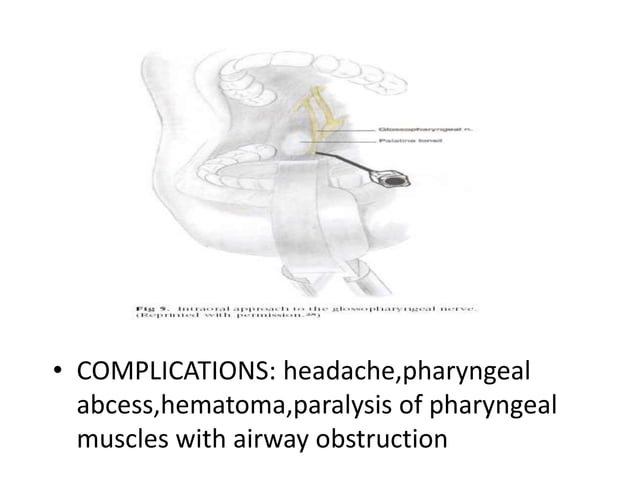 Awake intubation | PPTX