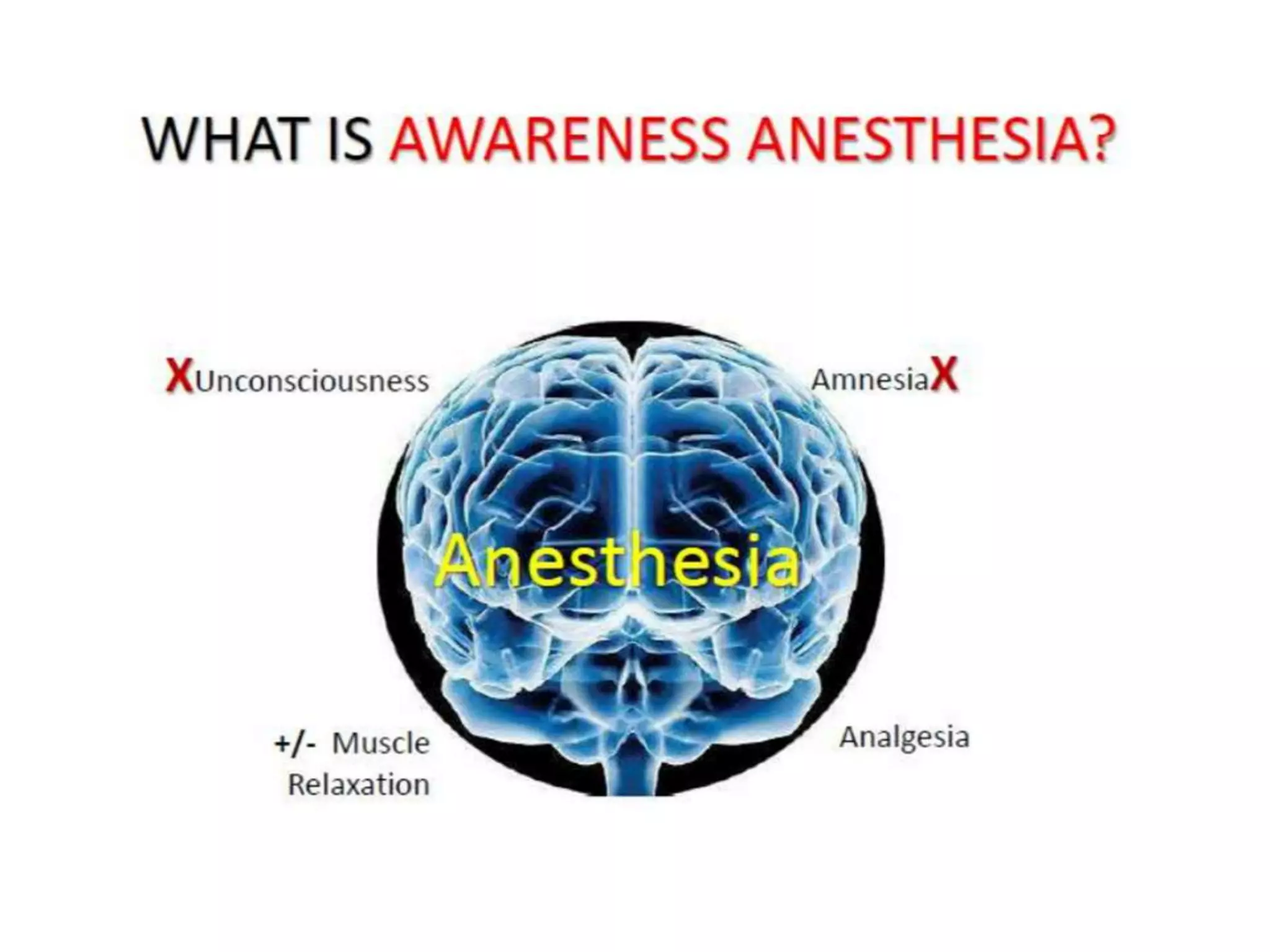 Awareness during anesthesia | PPTX
