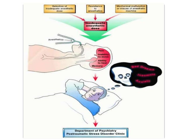 Awareness during anesthesia | PPTX | Surgery | Medical Health