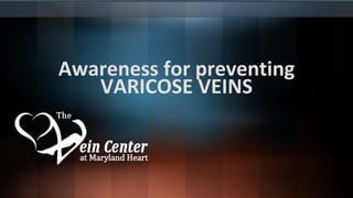 Awareness for preventing varicose veins | PPTX