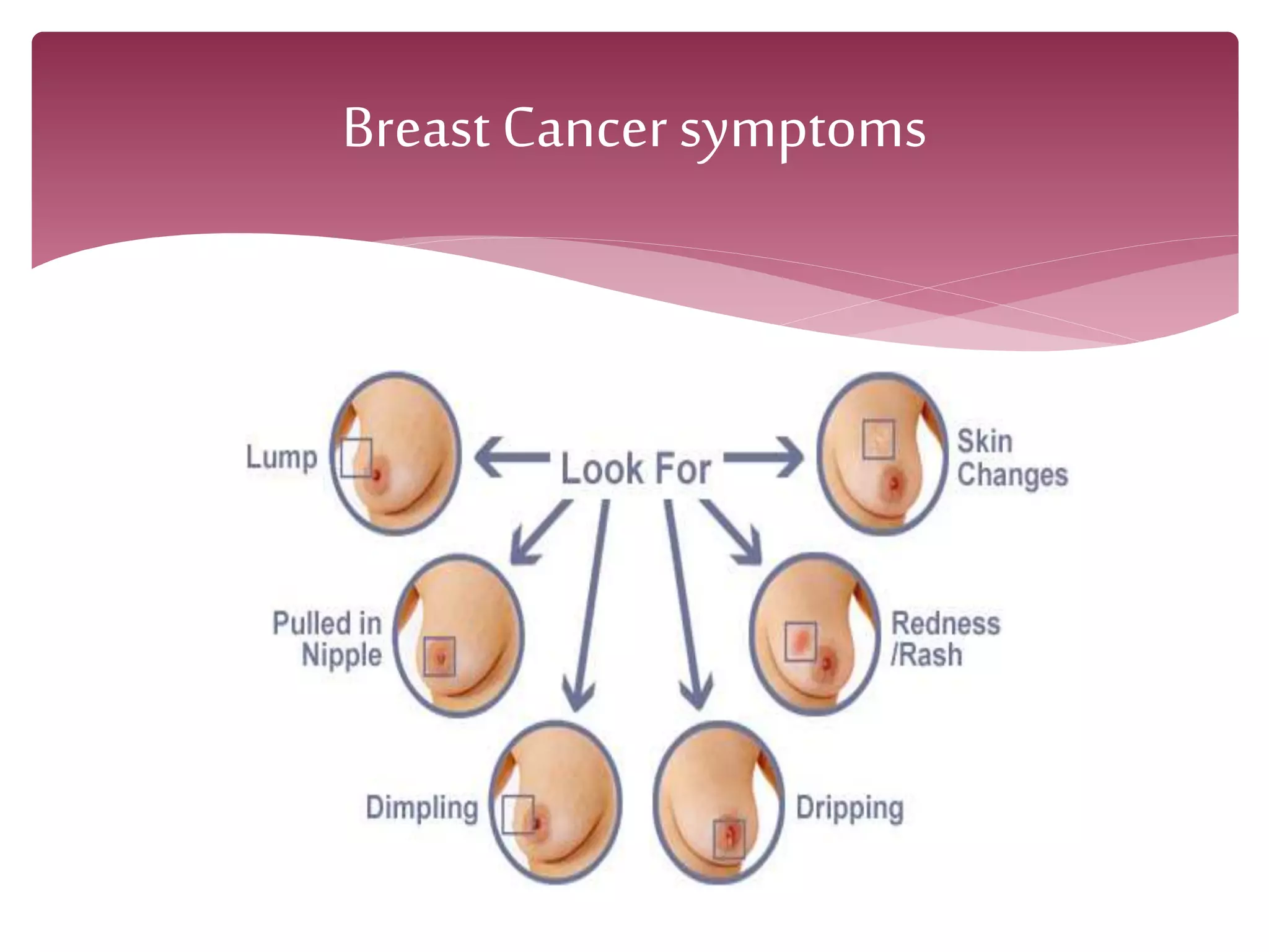 Breast cancer awareness - Causes, Diagnosis, Treatment and Prevention ...