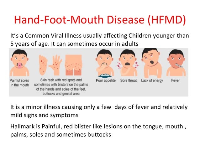 Awareness on seasonal fever