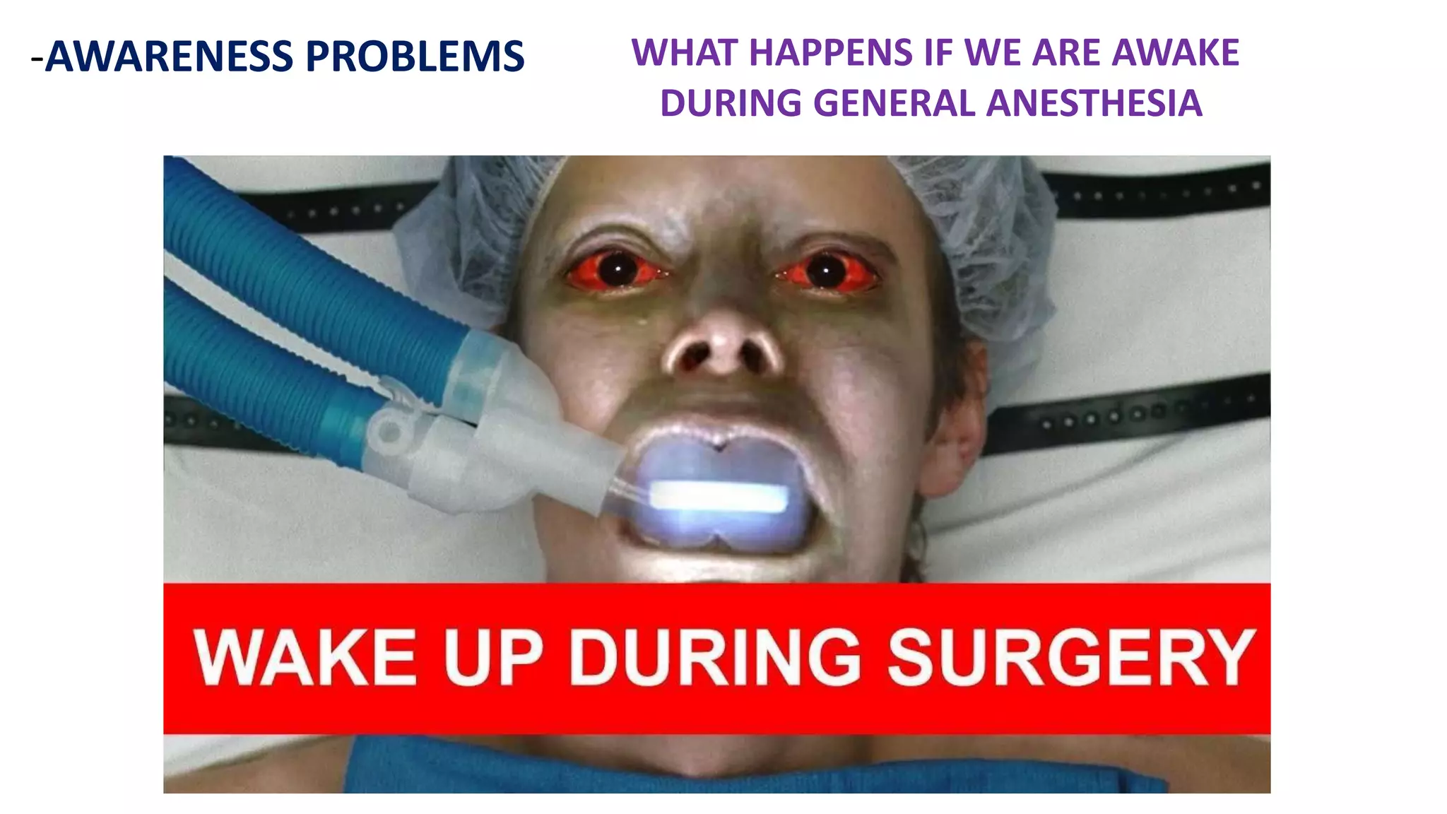 #Awareness problem during operation | PPTX