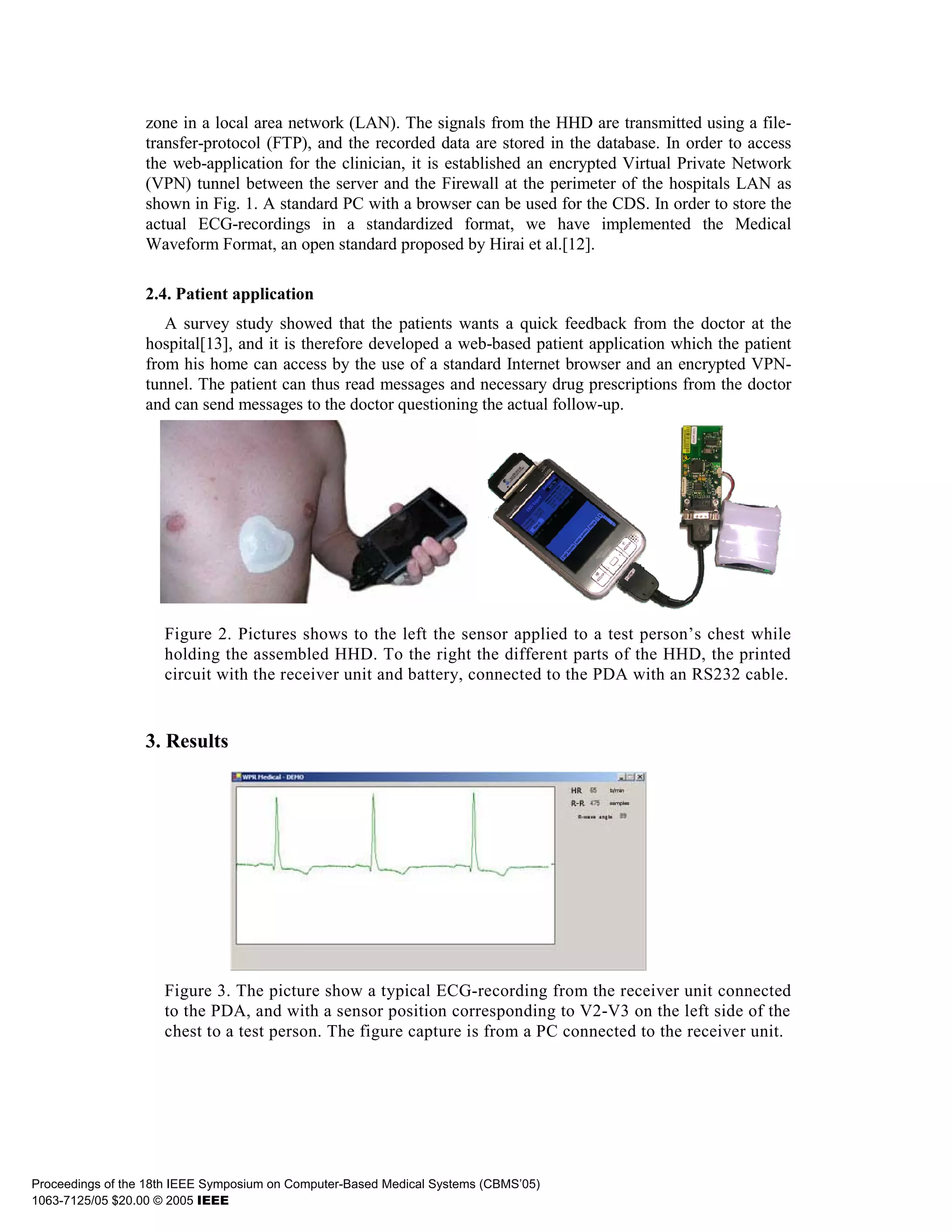 A wearable ecg recording system for continuous arrhythmia | PDF | Heart ...