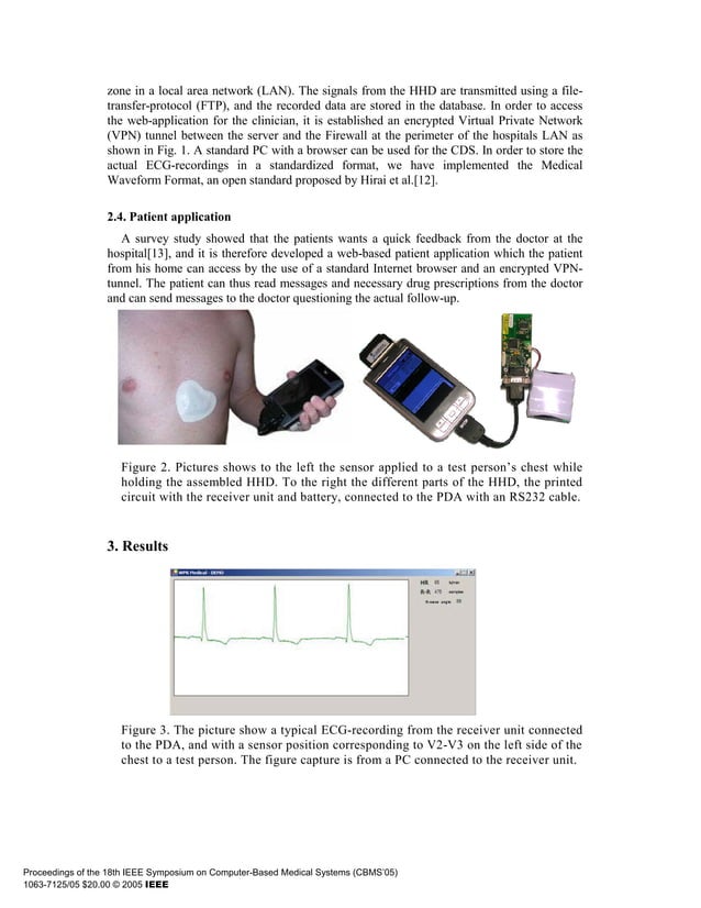 A wearable ecg recording system for continuous arrhythmia | PDF