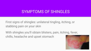 Shingles: mini project | PPTX