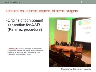 Hernia and Abdominal Wall Reconstruction 2017 | PPT