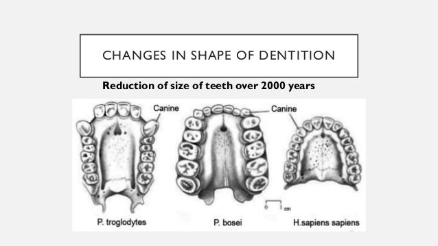 Evolution of teeth in vertebrates