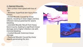 Axe injury xxxx(surgery) 464568541 .pptx