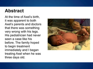 Axel: Arthrogryposis, Clubfeet, & Dislocated Hips and Knees Case Study ...