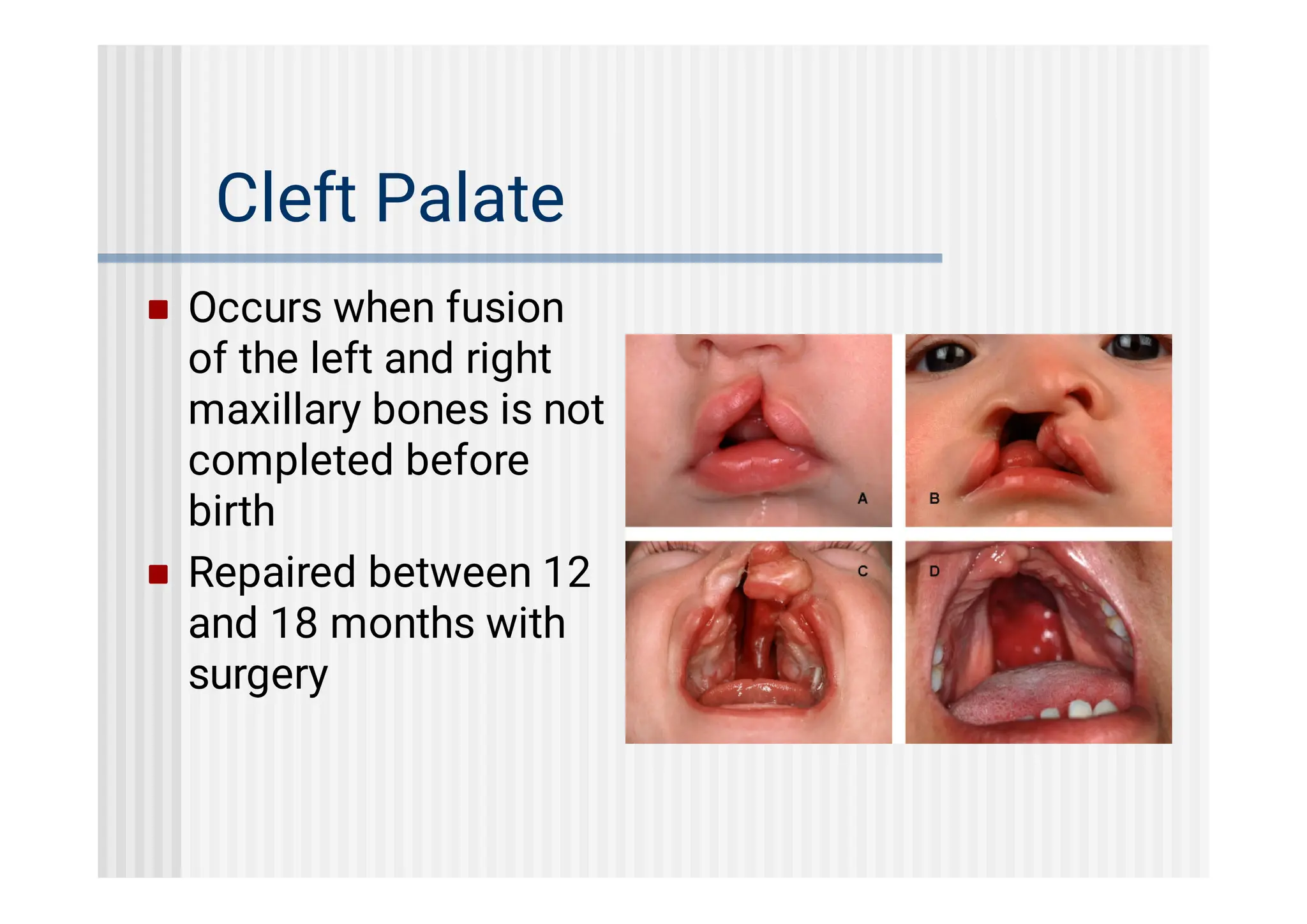 axial skeleton human anatomy. Mbbs....pdf