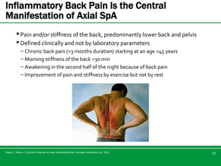 Axial sp a and its management | PPTX