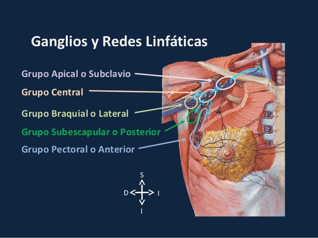 Linfonodomegalia Axilar Linfonodomegalia Axilar